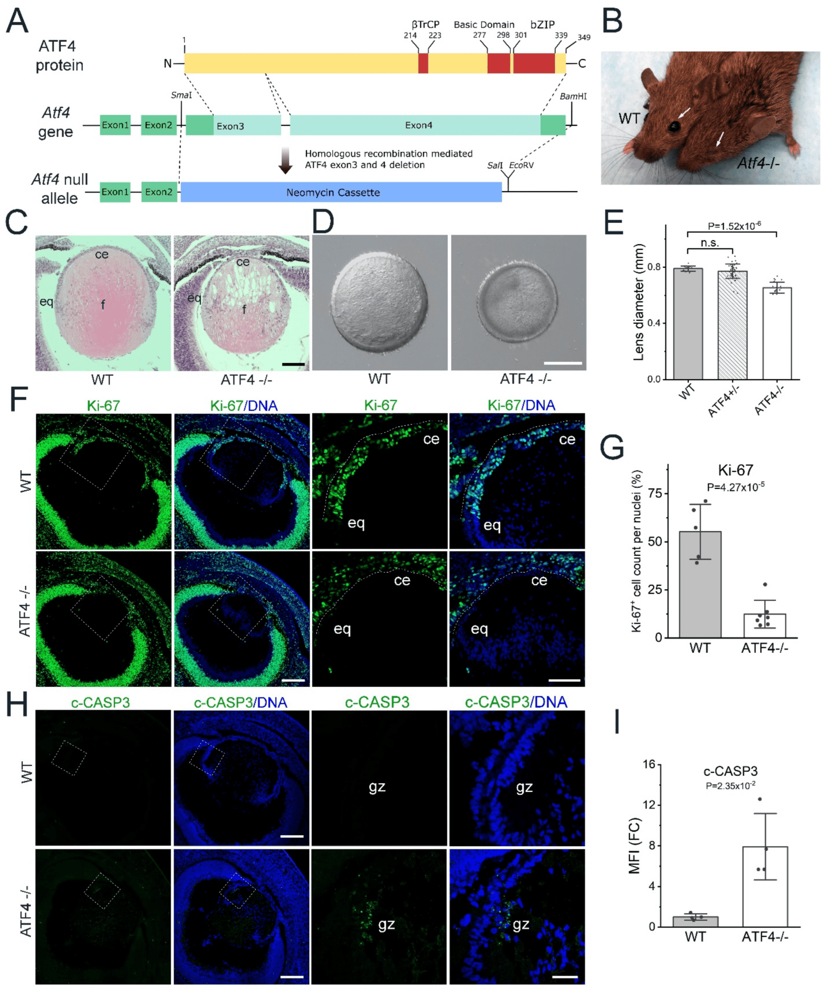 ATF 4: Descubriendo Qué Significa Y Su Importancia